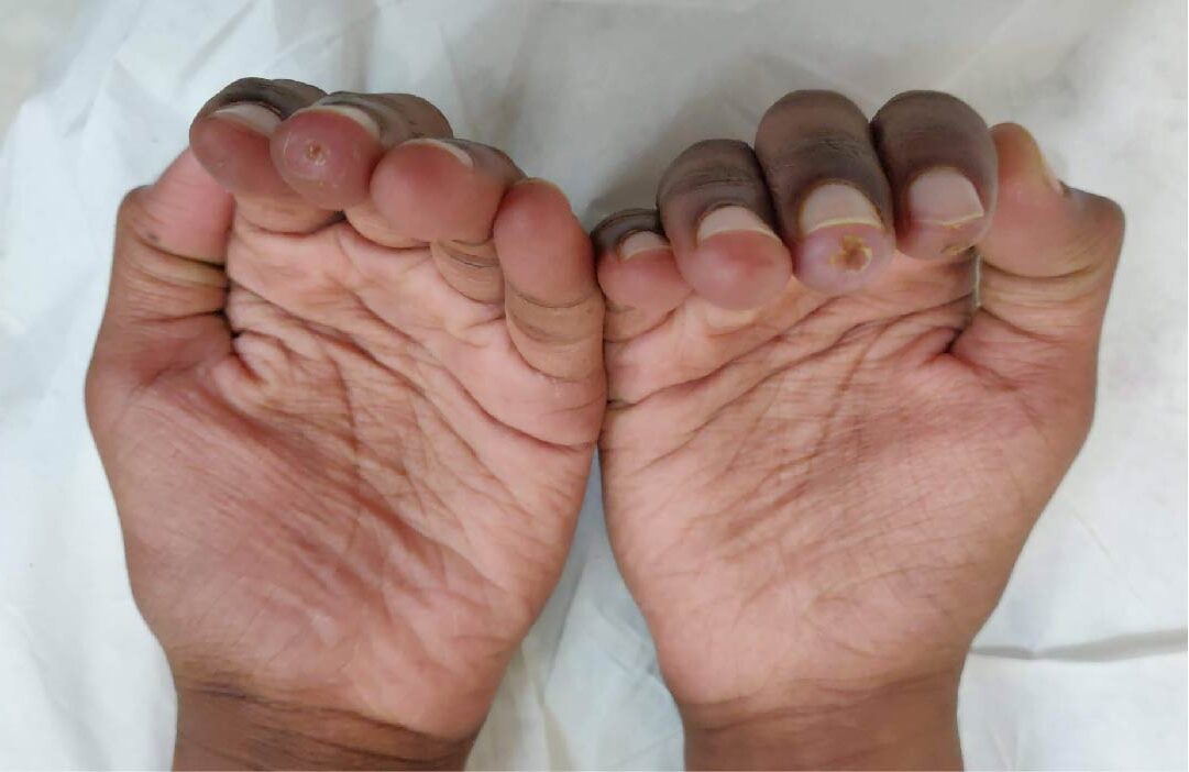 Information for Parents/providers – Rheumatologist 4 kids